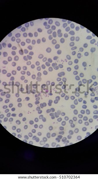 Platelet Clumping Stock Photo 510702364 | Shutterstock
