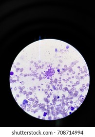 162 Platelet clumping Images, Stock Photos & Vectors | Shutterstock