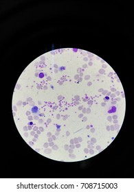 Leucocytozoon Chicken Blood Circulation Blood Smear Stock Photo (Edit ...