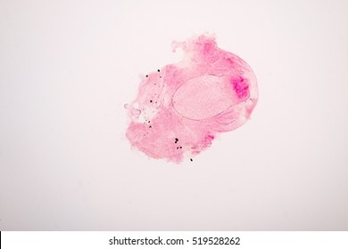 Plerocercoid Parasite Under Microscope Stock Photo 519528262 | Shutterstock