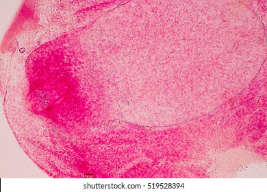 Paramphistomiasis Images, Stock Photos & Vectors | Shutterstock