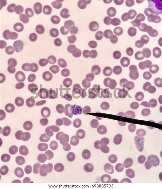 Foto stock de Pointer Malaria Plasmodium Vivax Schizont Form (editar ...
