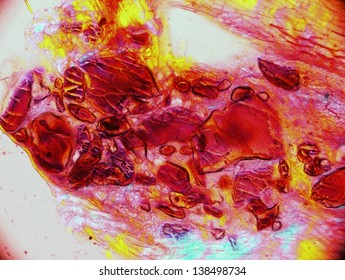 Osteoplast Images, Stock Photos & Vectors | Shutterstock