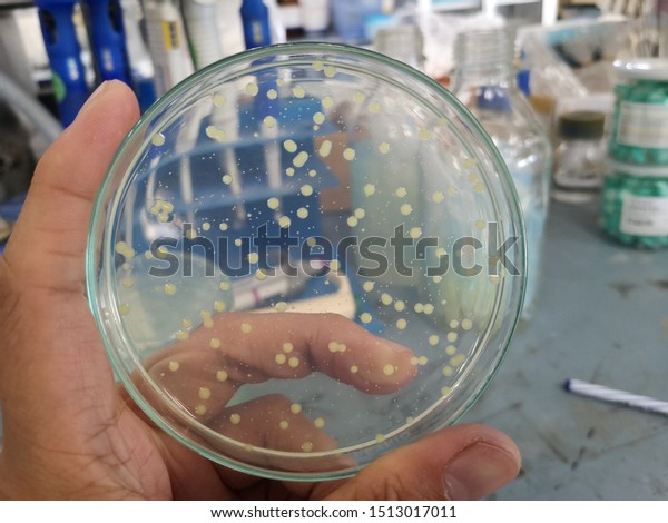 Pour Plate Technique Count Number Bacteria Stock Photo (Edit Now ... Pour Plate Technique Count Number Bacteria Stock Photo (Edit Now ...