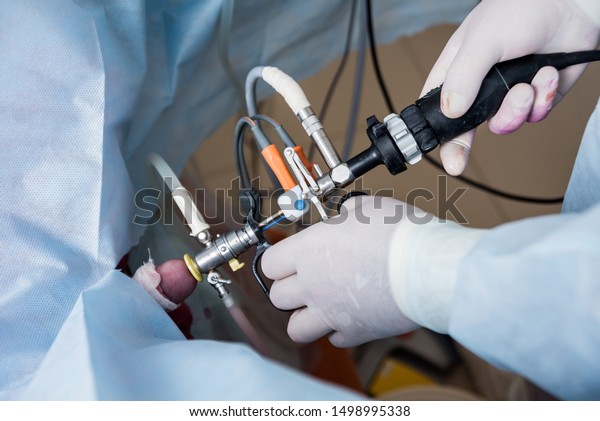 Process Urological Surgery Operation Using Laparoscopic Stock Photo ...