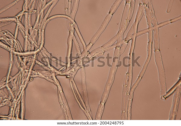 Professional Light Microscope Image Mold Fungus Stock Photo 2004248795 ...