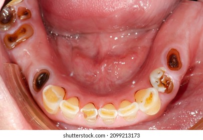 Proper Good Alignment Teeth Stock Photo 2099213173 | Shutterstock