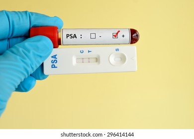 Blood Sample Psa Prostatespecific Antigen Positive Stock Photo ...