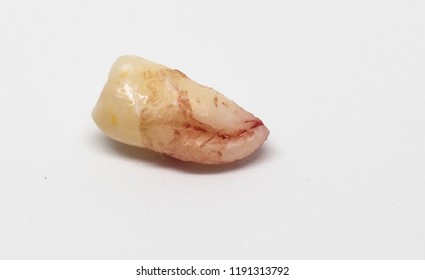 Pulled Teeth Horrifying Root On White写真素材1191313792 | Shutterstock