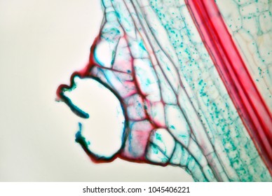 Pumpkin stem under microscope : 17 images, photos et images ...
