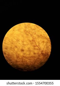 Pythium Under Microscope On Agar Magnification Stock Photo 1554700355 ...
