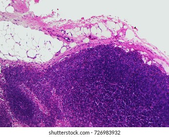 3 Rabbit lymphatic system Images, Stock Photos & Vectors | Shutterstock