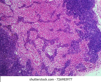3 Rabbit lymphatic system Images, Stock Photos & Vectors | Shutterstock