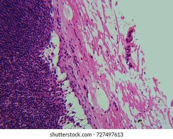 13 imagens de Rabbit lymph node section Imagens, fotos stock e vetores ...