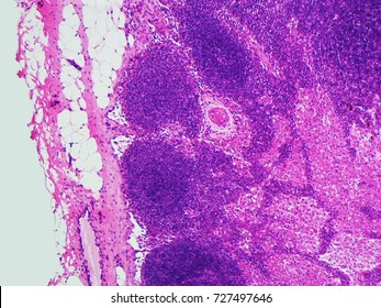 13 imagens de Rabbit lymph node section Imagens, fotos stock e vetores ...