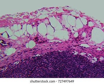 13 imagens de Rabbit lymph node section Imagens, fotos stock e vetores ...