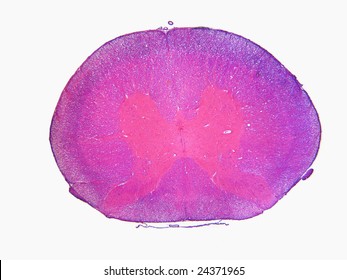 Rabbit Spinal Column Cross Section Magnification Foto Stok 24371965 ...