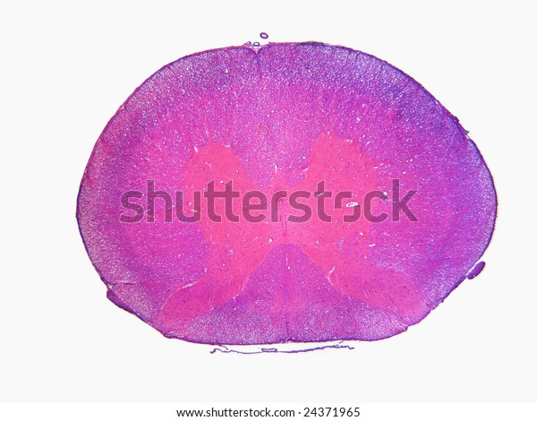 Rabbit Spinal Column Cross Section Magnification Stock Photo 24371965 ...