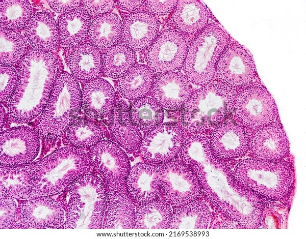 Rabbit Testicle Cross Section Under Microscope Foto Stok 2169538993 ...