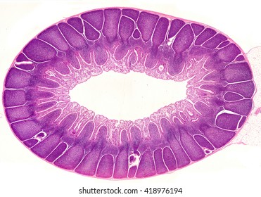 275 Vermiform appendix Images, Stock Photos & Vectors | Shutterstock