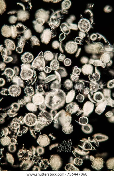 Radiolarians Under Microscope Stock Photo 756447868 | Shutterstock
