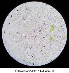 Fusarium Oxysporum Colony Culture On Pda Stock Photo (Edit Now) 1786396142