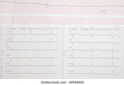 Real Cardiological Test Suitable Background Stock Photo 69964450 ...