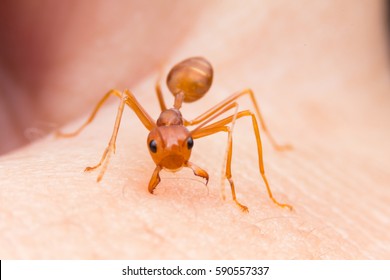 8,315 Red ant bite Images, Stock Photos & Vectors | Shutterstock