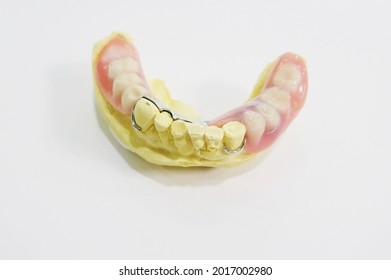Removable Partial Denture Mandible Stock Photo 2017002980 | Shutterstock