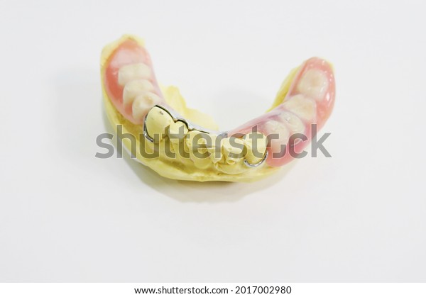 Removable Partial Denture Mandible Stock Photo 2017002980 | Shutterstock