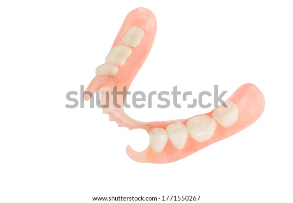 Removable Plastic Partial Denture On White Stock Photo 1771550267 ...