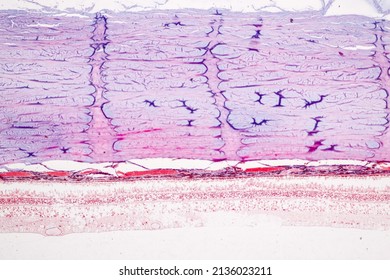 231 Tear ducts Stock Photos, Images & Photography | Shutterstock