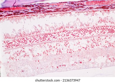 231 Tear ducts Stock Photos, Images & Photography | Shutterstock