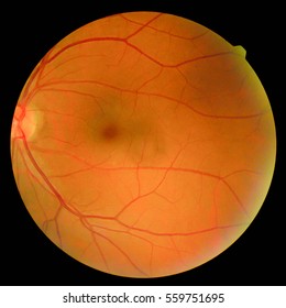 Retinal Stock Photo 559751695 | Shutterstock