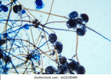 9,485 Microscopic Mold Images, Stock Photos & Vectors | Shutterstock