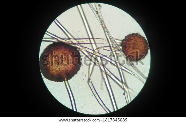 Rhizopus Sp Under Microscope High Power Stock Photo 1617345085 ...