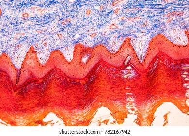 Scar Tissue Under Microscope Stock Photo (Edit Now) 782167942