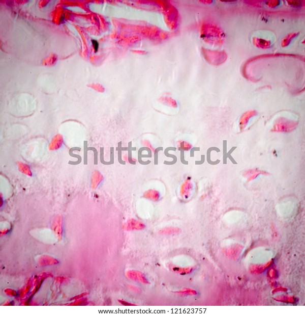 Science Micrograph Bone Cell Osteocyte Stock Photo 121623757 | Shutterstock