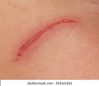 Scratch On Face Stock Photo 554161561 | Shutterstock