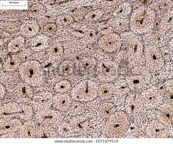Section Bone Stained Mounted Microscopy Stock Photo (Edit Now) 1071079514