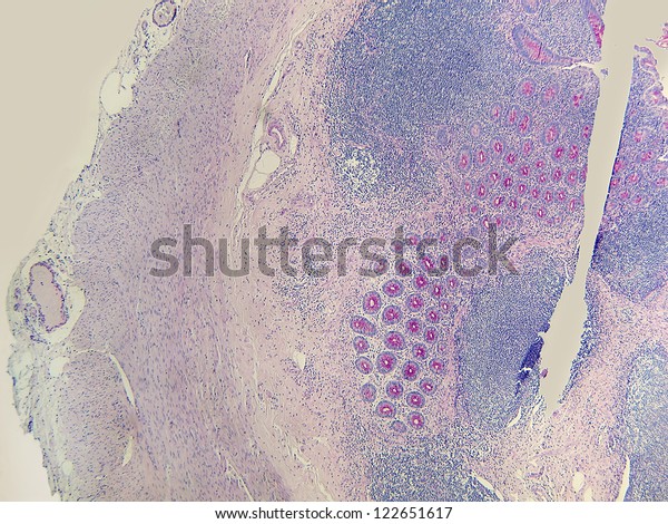 Section Human Appendix Showing Crypts Lieberkuhn Stock Photo (Edit Now ...