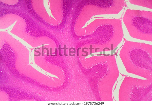 Section Human Cerebellum Under Microscope Foto stock 1975736249 ...