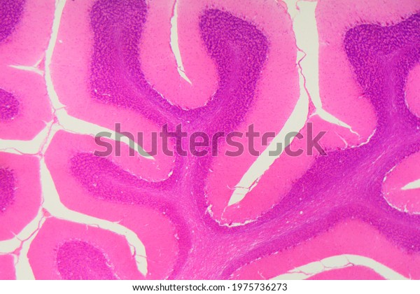 Section Human Cerebellum Under Microscope Stock Photo 1975736273 ...