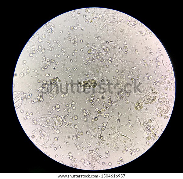 Sediment Urine Finding Microscopemoderate Bacteria White Stock Photo ...