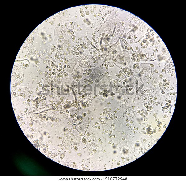 Sediment Urine Finding Microscopemoderate Bacteria White Stock Photo ...