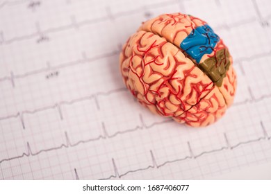 506 Selective memory loss Images, Stock Photos & Vectors | Shutterstock