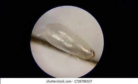 Lice eggs Images, Stock Photos & Vectors | Shutterstock