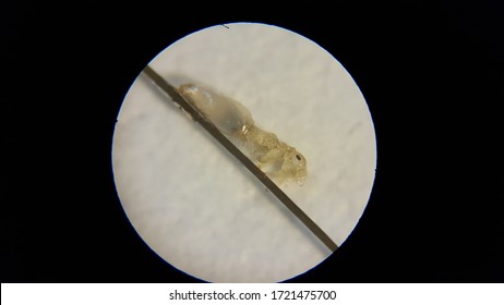 368 Lice microscope Images, Stock Photos & Vectors | Shutterstock