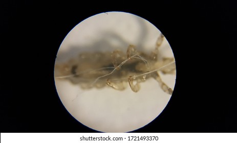 368 Lice microscope Images, Stock Photos & Vectors | Shutterstock
