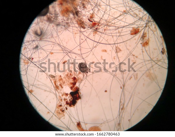 Showing Ear Mite Microscope View Stock Photo 1662780463 | Shutterstock